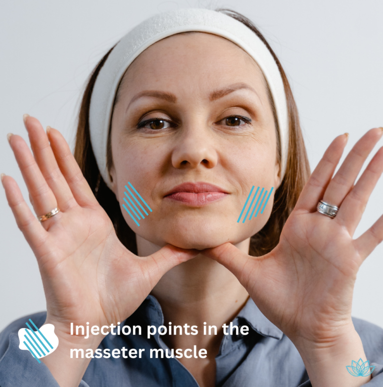 masseter-jawline-example - Pro Aesthetics